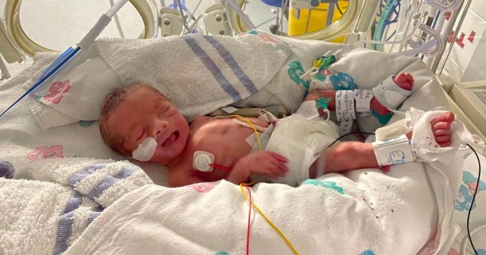 Baby with disability born before UK abortion limit for babies with ...