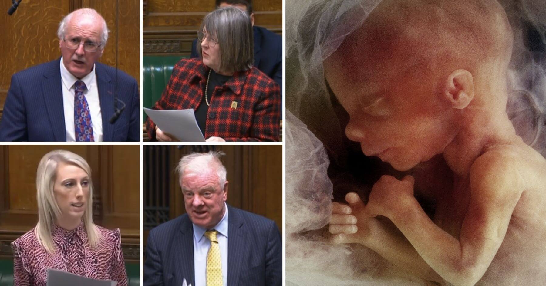 MPs line up to support pro-life law changes