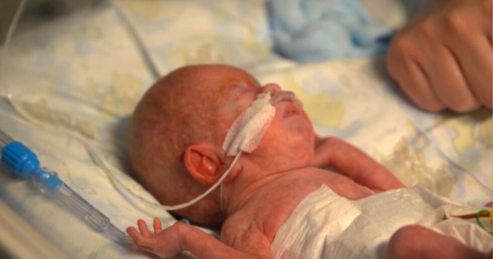 Baby Alfie born at 27 weeks and weighing 640 grams defies the odds