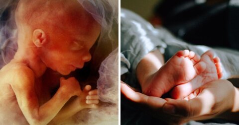 Premature baby born at 24 weeks now “meeting all his milestones”