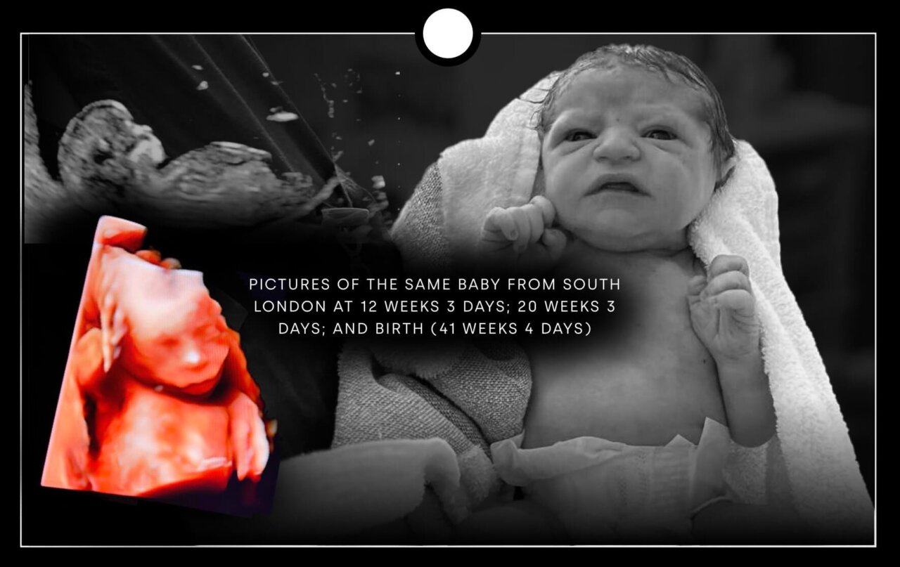 Write to your MP to stop abortion up to birth - Easy tool - No To ...