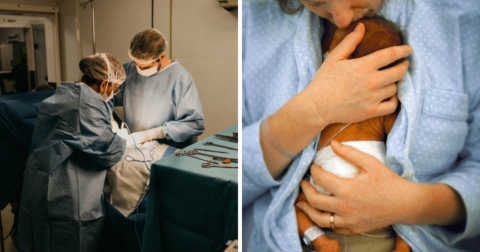 Born at 33 weeks, baby girl has life-saving surgery days after birth ...
