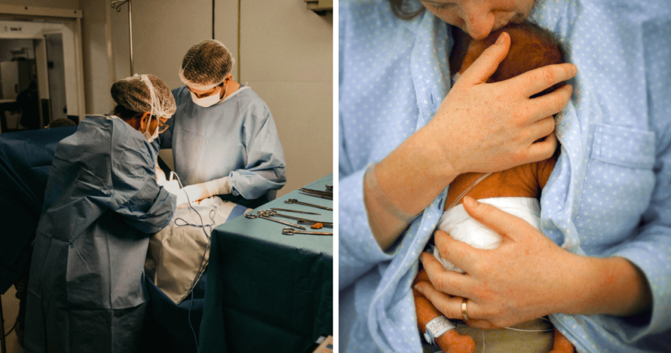 Born at 33 weeks, baby girl has life-saving surgery days after birth ...